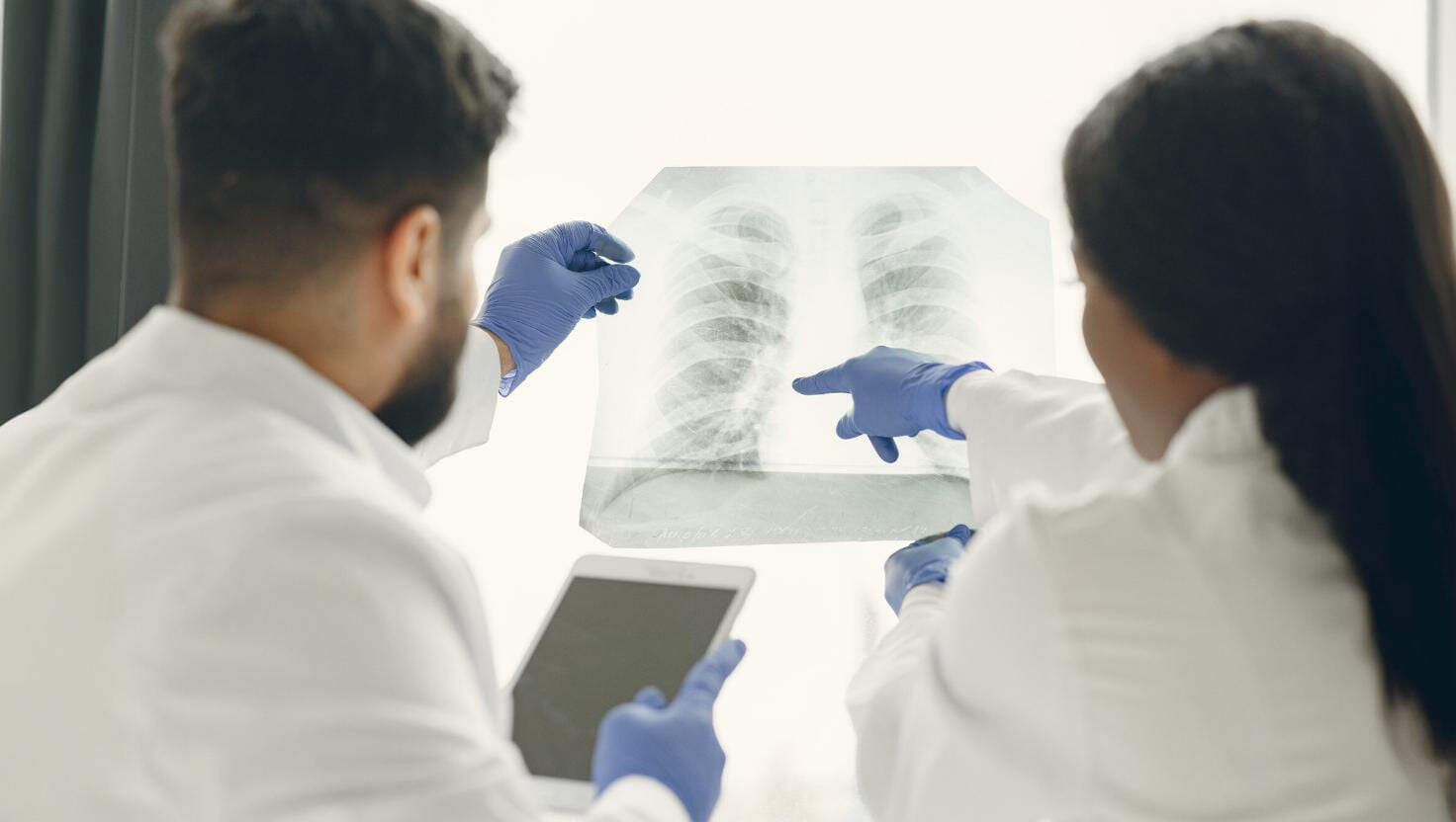 Fibrose Pulmonar Idiopática: Sintomas, Diagnóstico e Tratamentos ...